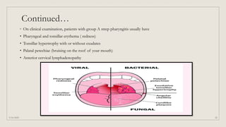Unveiling Pharyngitis: Causes, Symptoms, Diagnosis, and Treatment ...
