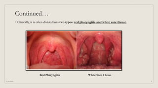 Unveiling Pharyngitis: Causes, Symptoms, Diagnosis, and Treatment ...