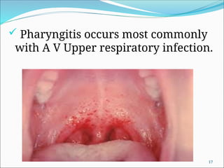 PHARYNGITIS FOR BSC NSG, GNM,MSC NURSING | PPTX