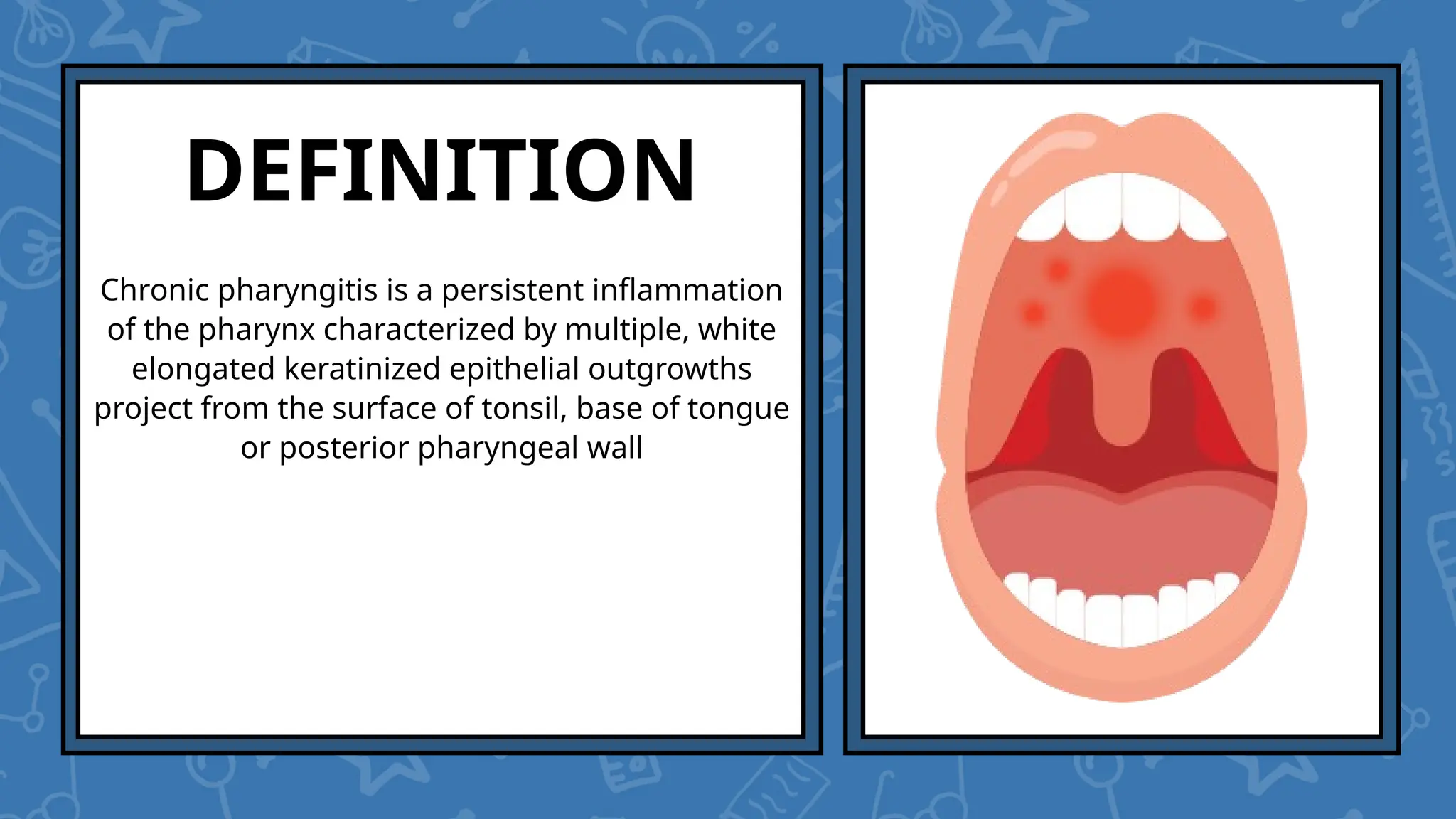 PHARYNGITIS- Types, causes and treatment | PPTX