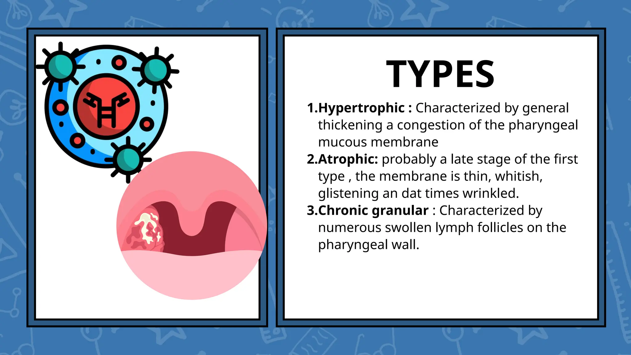 PHARYNGITIS- Types, causes and treatment | PPTX