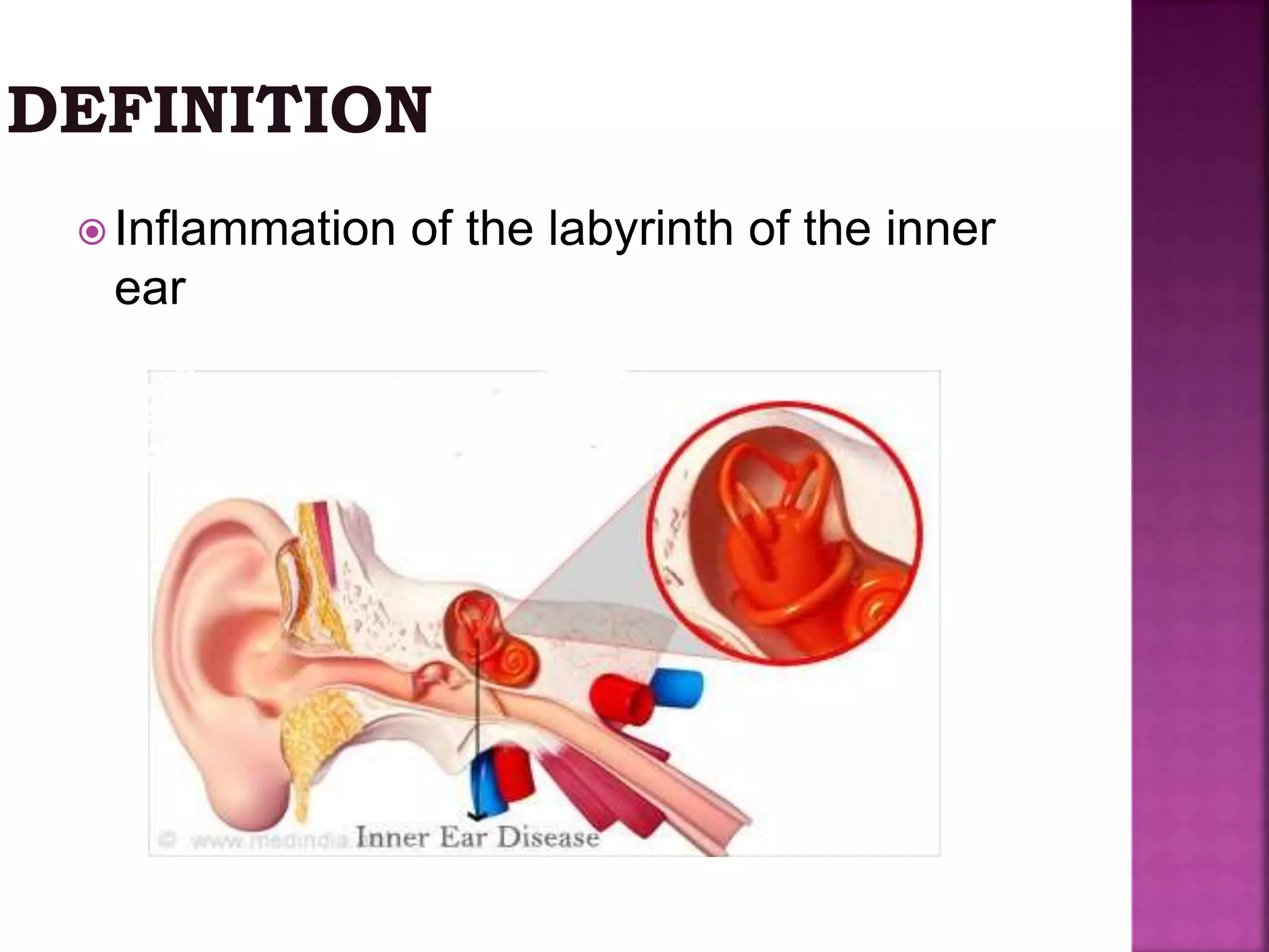 Pharyngitis & labyrinthitis | PPT