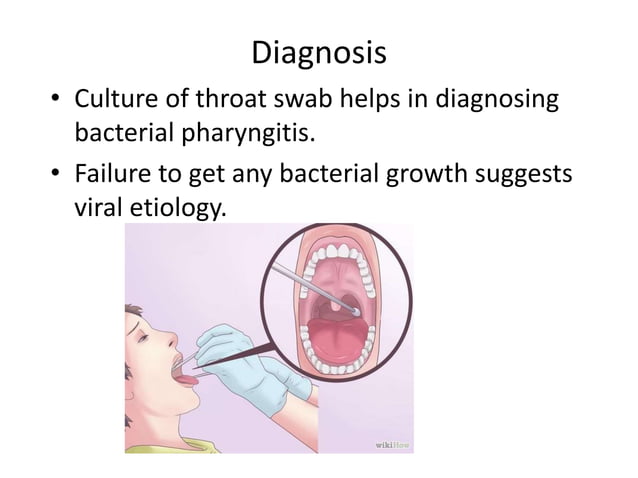 Pharyngitis n oral cavity | PPT