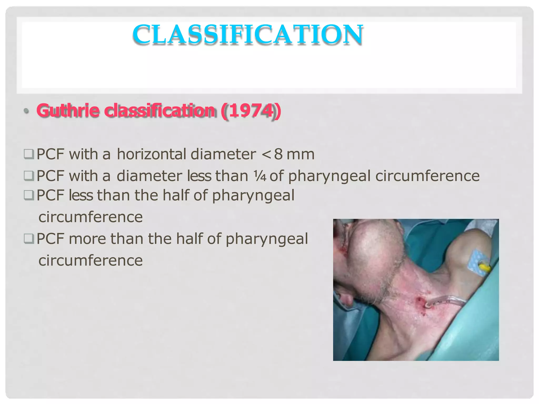 Pharyngocutaneous-fistula (1).pptx