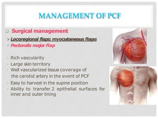 Pharyngocutaneous-fistula (1).pptx