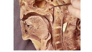 Anatomy of Pharynx | PPTX
