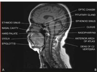 Pharynx Anatomy | PPTX