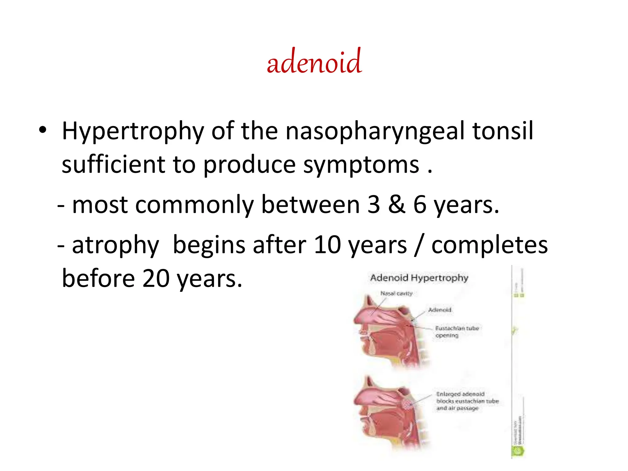 pharynx & adenoid.pptx..................... | PPT