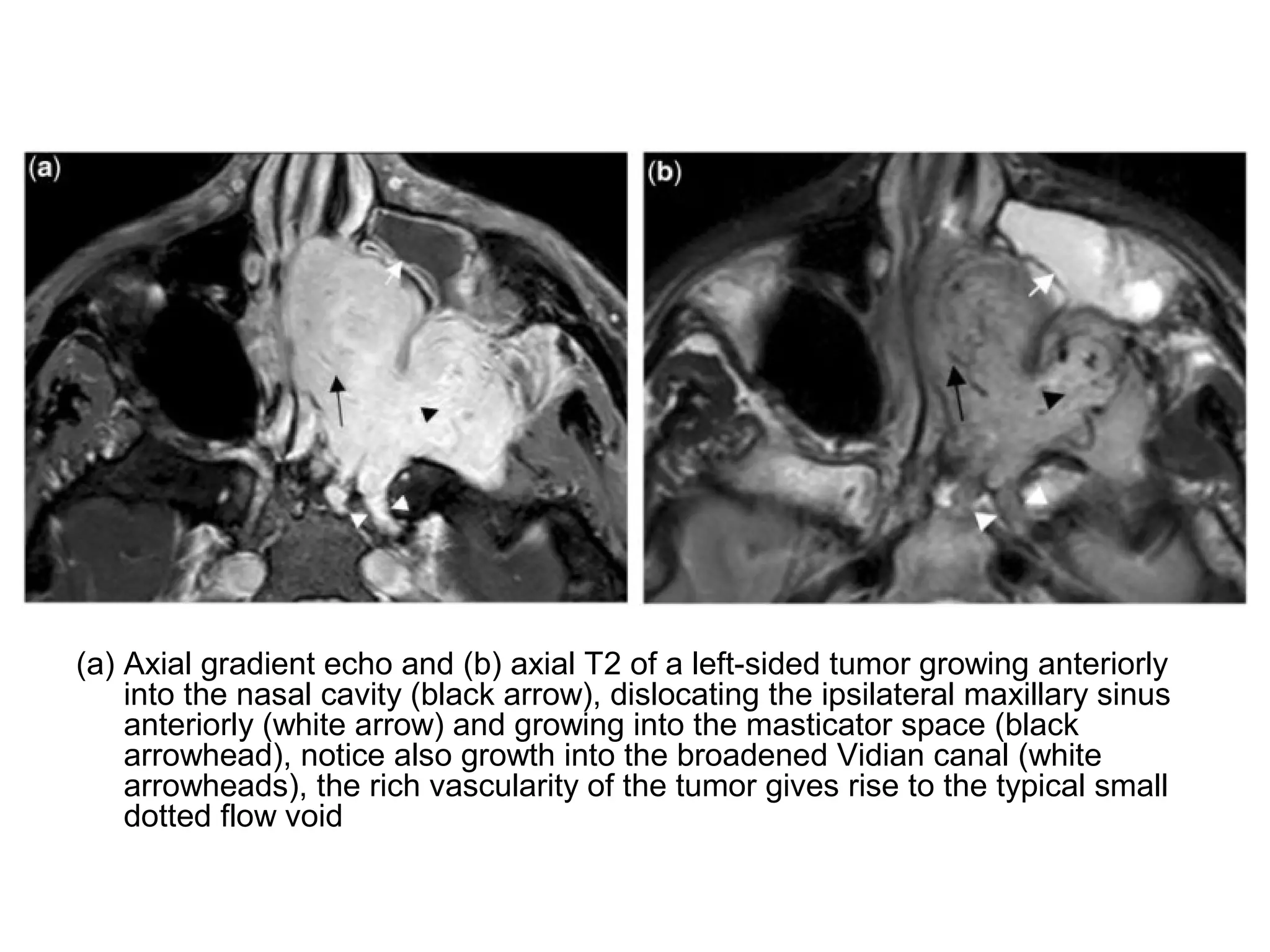Diagnostic Imaging of Pharynx & Larynx | PPT