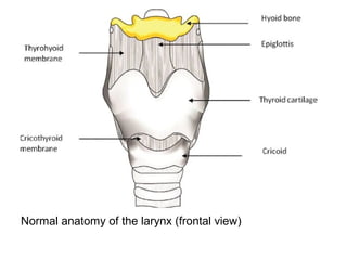 Diagnostic Imaging of Pharynx & Larynx | PPT