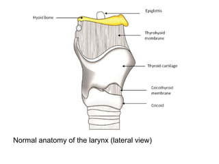 Diagnostic Imaging of Pharynx & Larynx | PPT