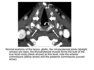 Diagnostic Imaging of Pharynx & Larynx | PPT