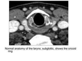Diagnostic Imaging of Pharynx & Larynx | PPT
