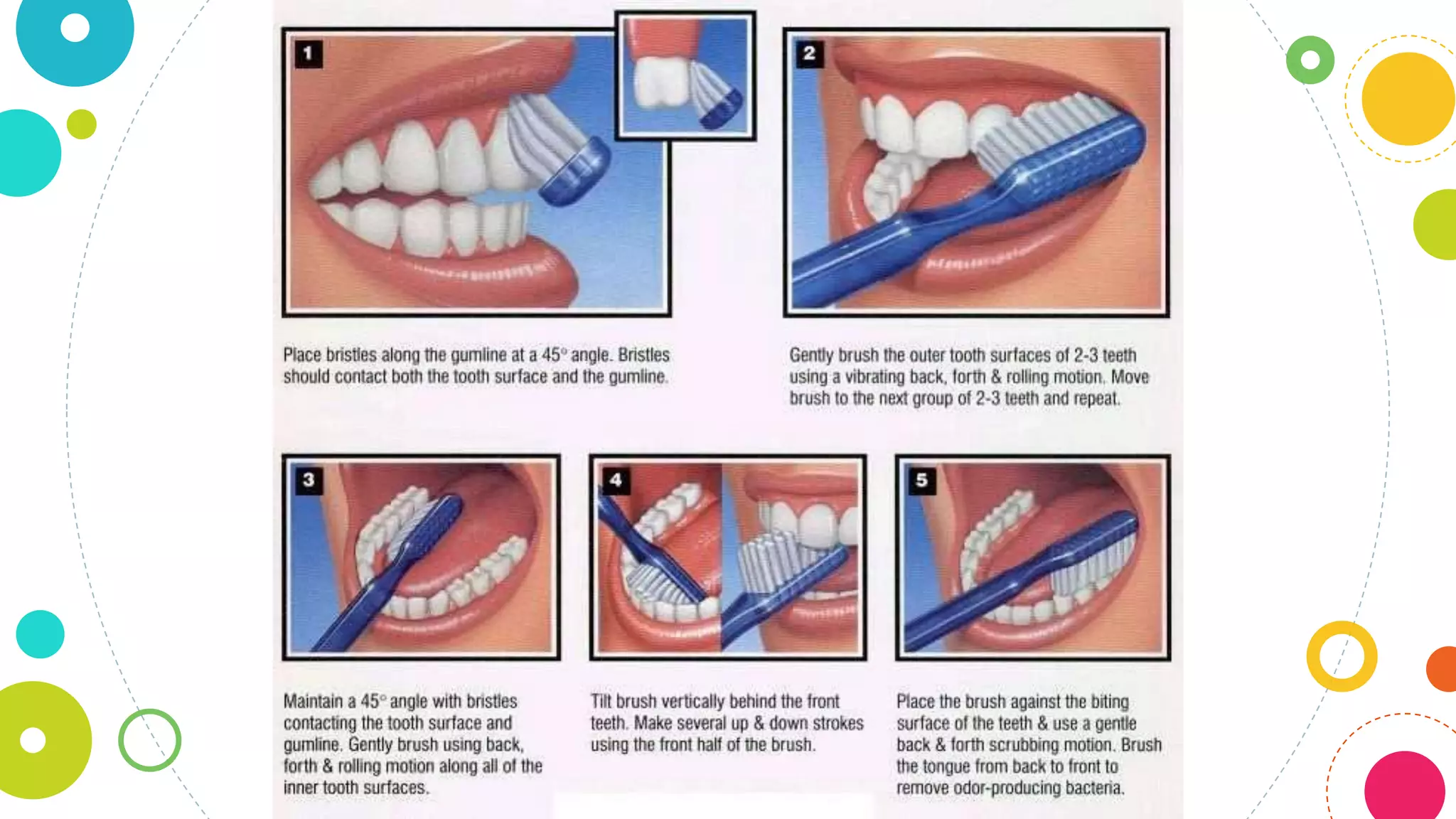 Phase 1 periodontal therapy | PPTX