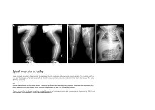 Phase 1 Therese Dernbrant | PDF