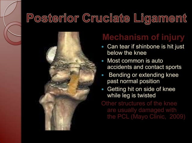 Injuries to ACL, PCL, and MCL | PPTX