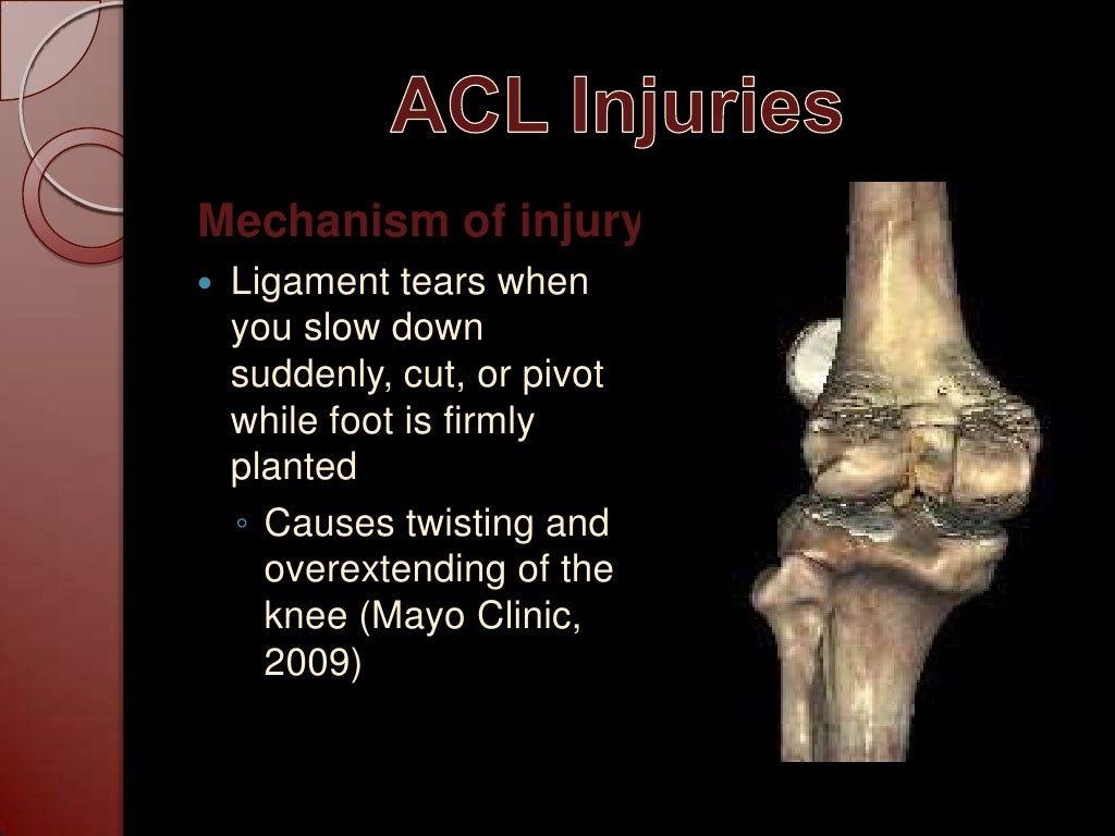 Injuries to ACL, PCL, and MCL