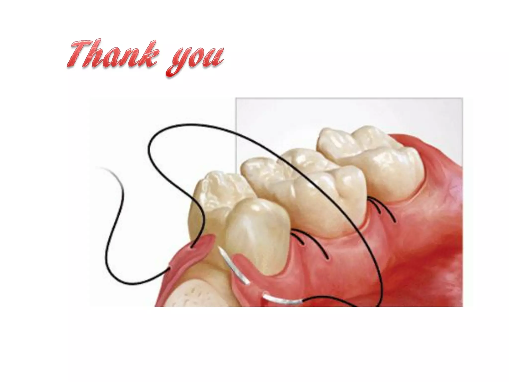 Phase II periodontal therapy | PDF