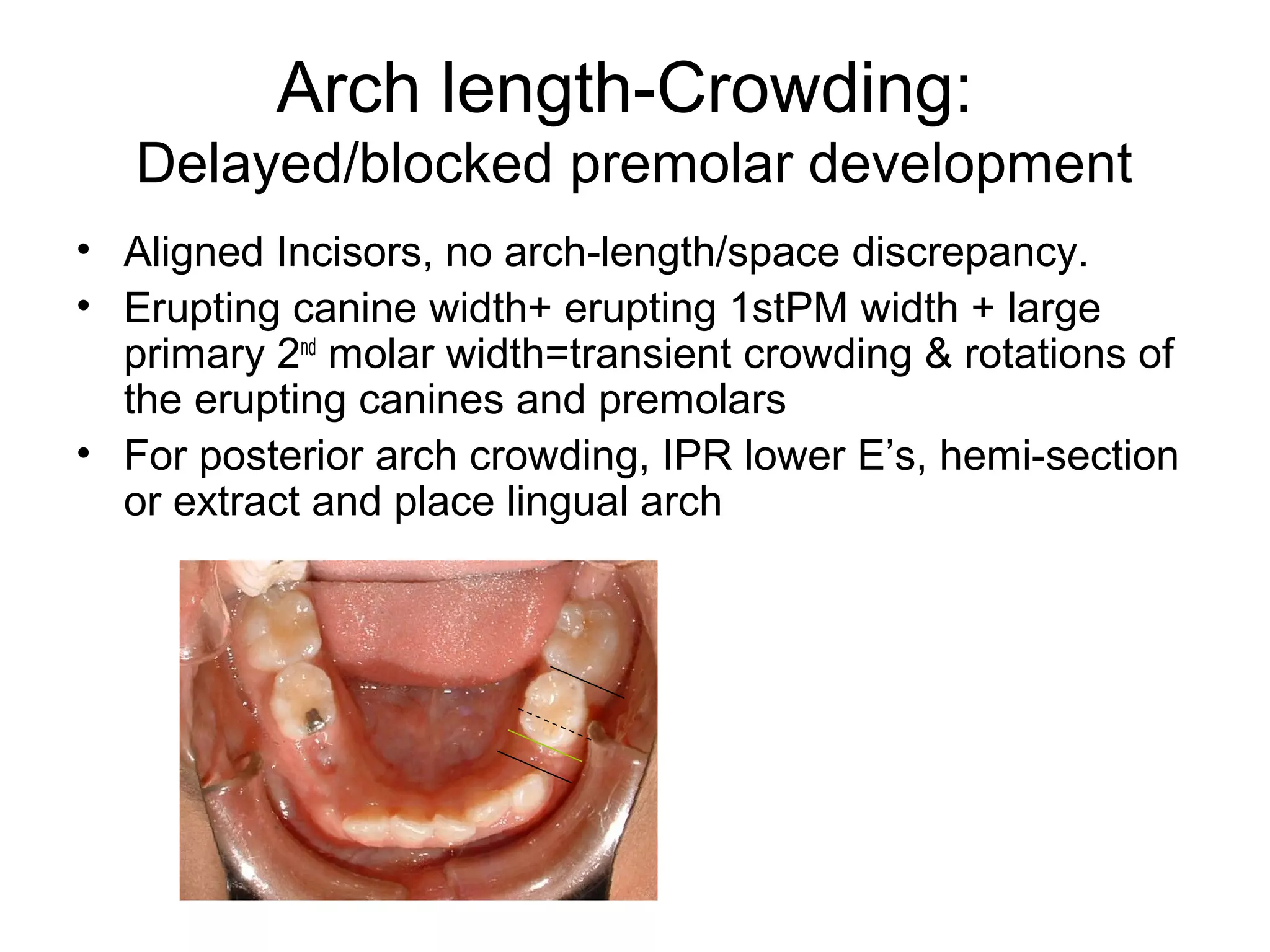 Phase I Orthodontic treatment | PPT