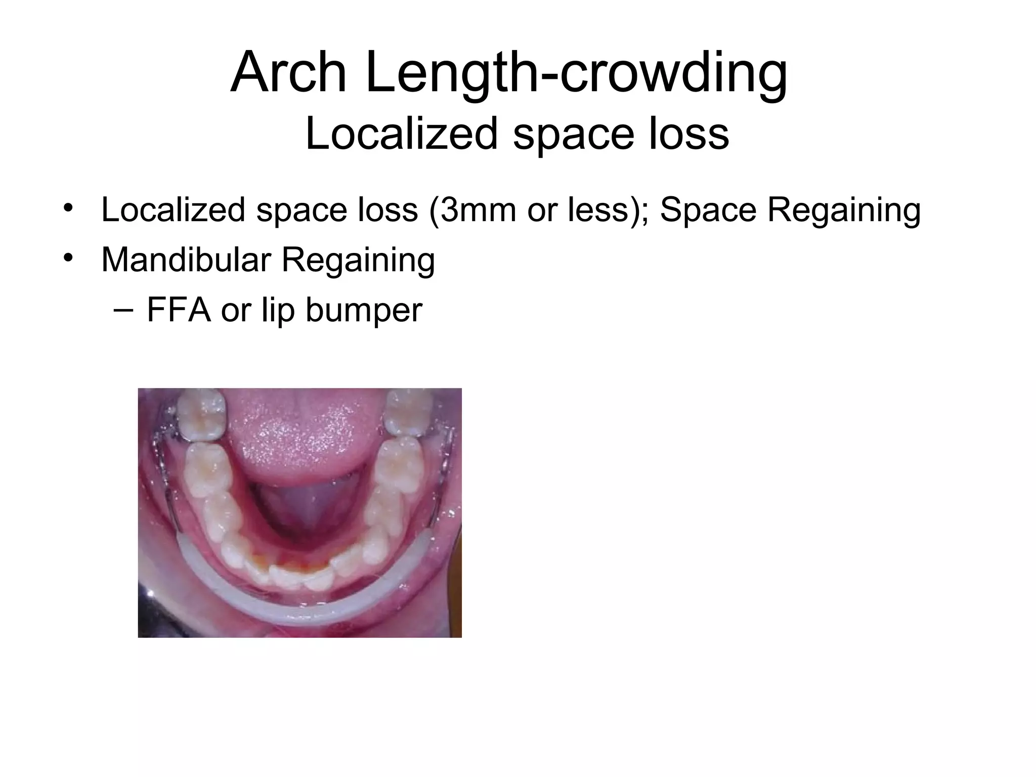 Phase I Orthodontic treatment | PPT