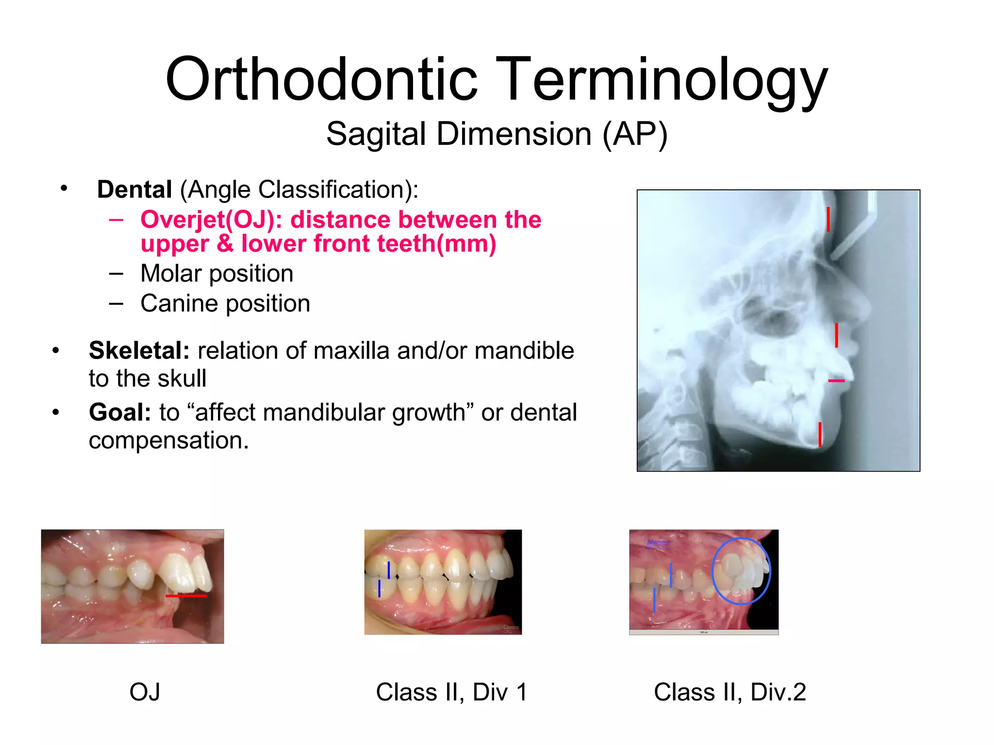 Phase I Orthodontic treatment | PPT