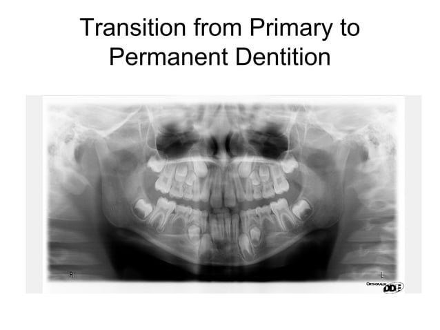 Phase I Orthodontic treatment | PPT | Dental Health | Diseases and ...