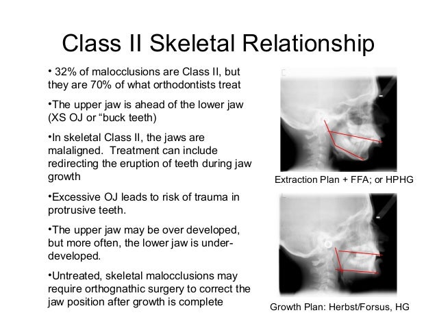 Phase I Orthodontic treatment