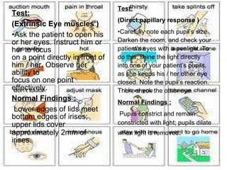 cranial nerves | PPT