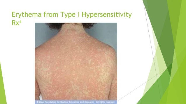 Cephalosporin use on Penicillin Allergy patients