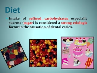 Epidemiology and prevention of Dental caries | PPTX