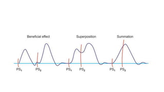 Muscle Fatigue Graph