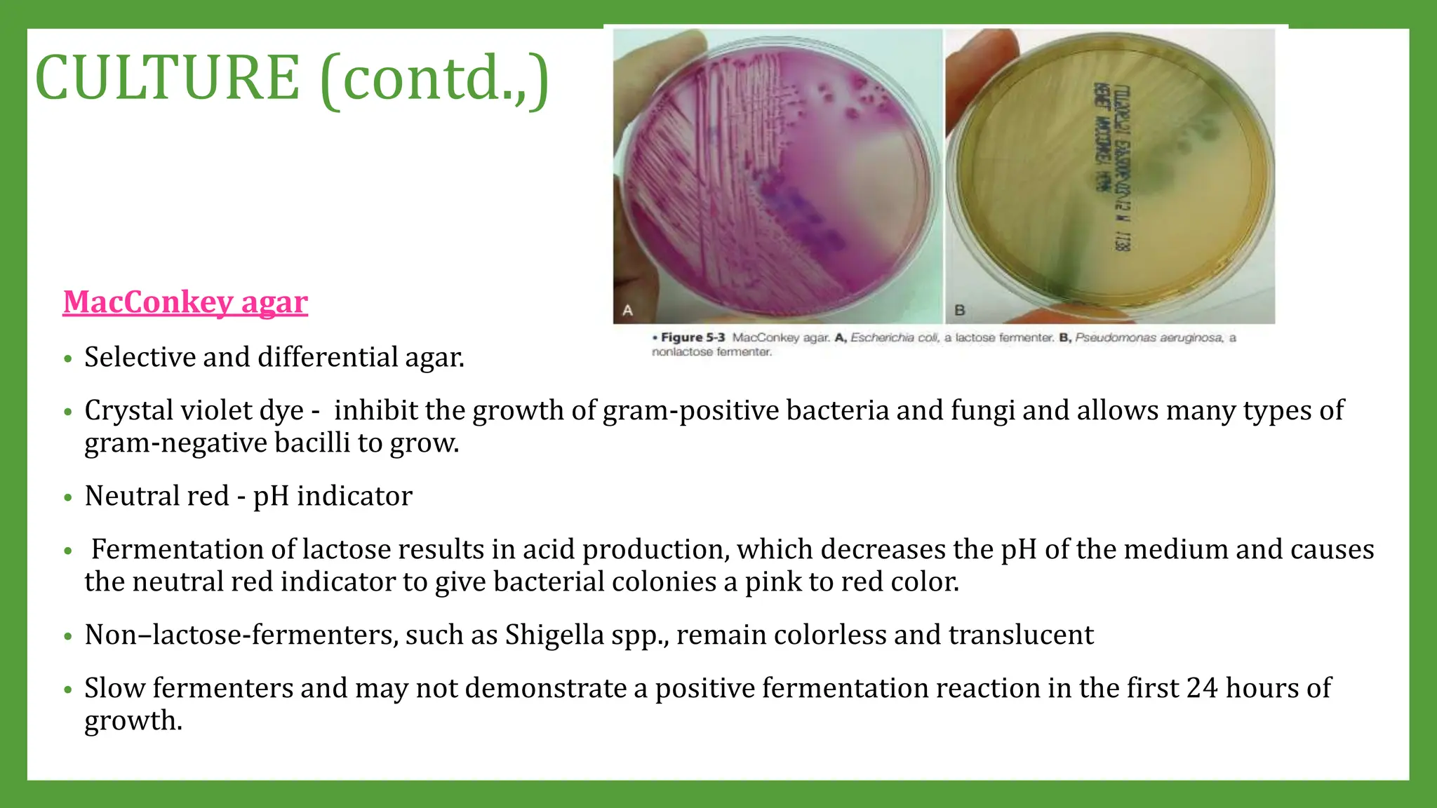 Phenotypic Methods Of Bacterial Identification Conventional