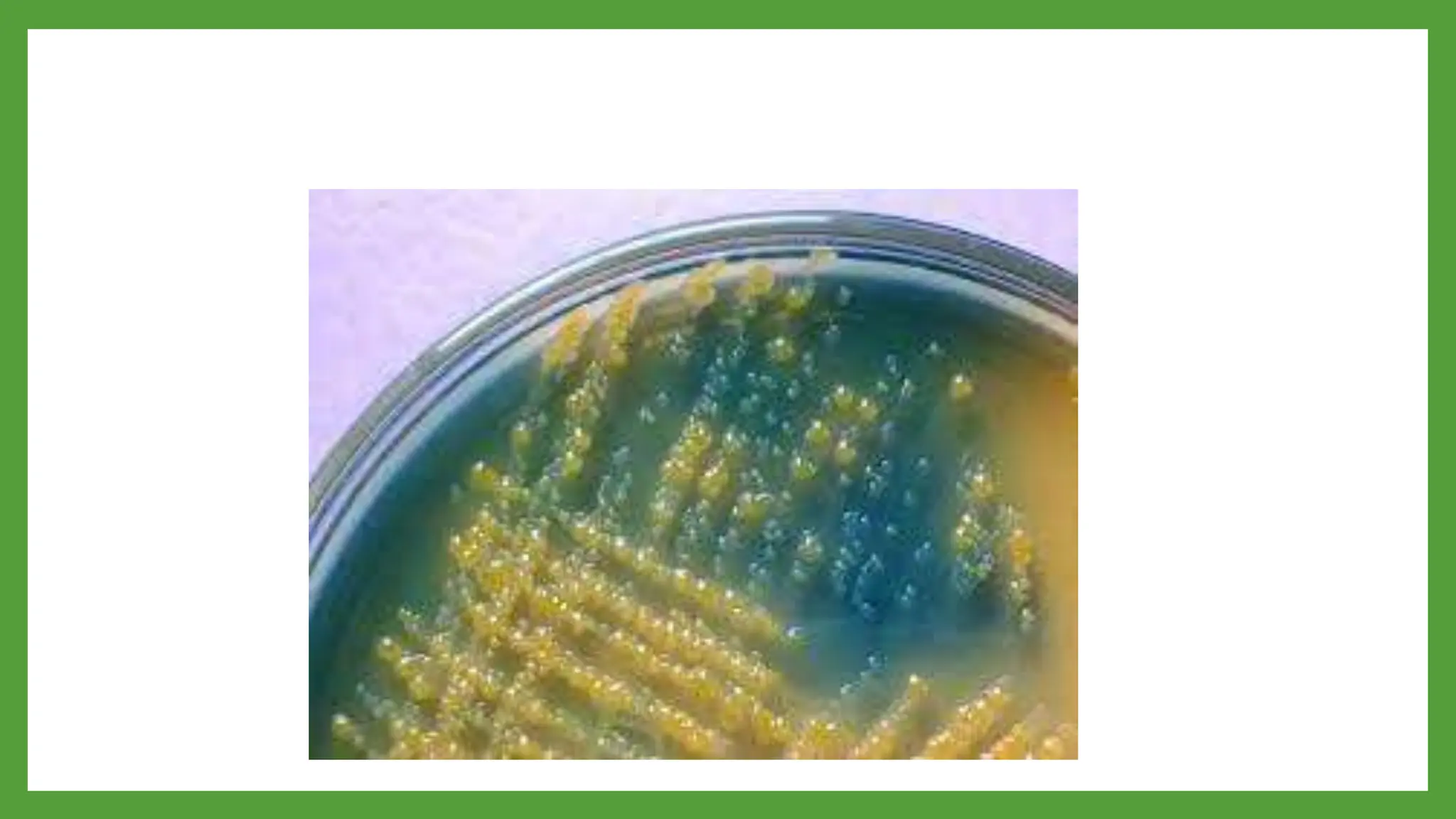 Phenotypic Methods Of Bacterial Identification Conventional