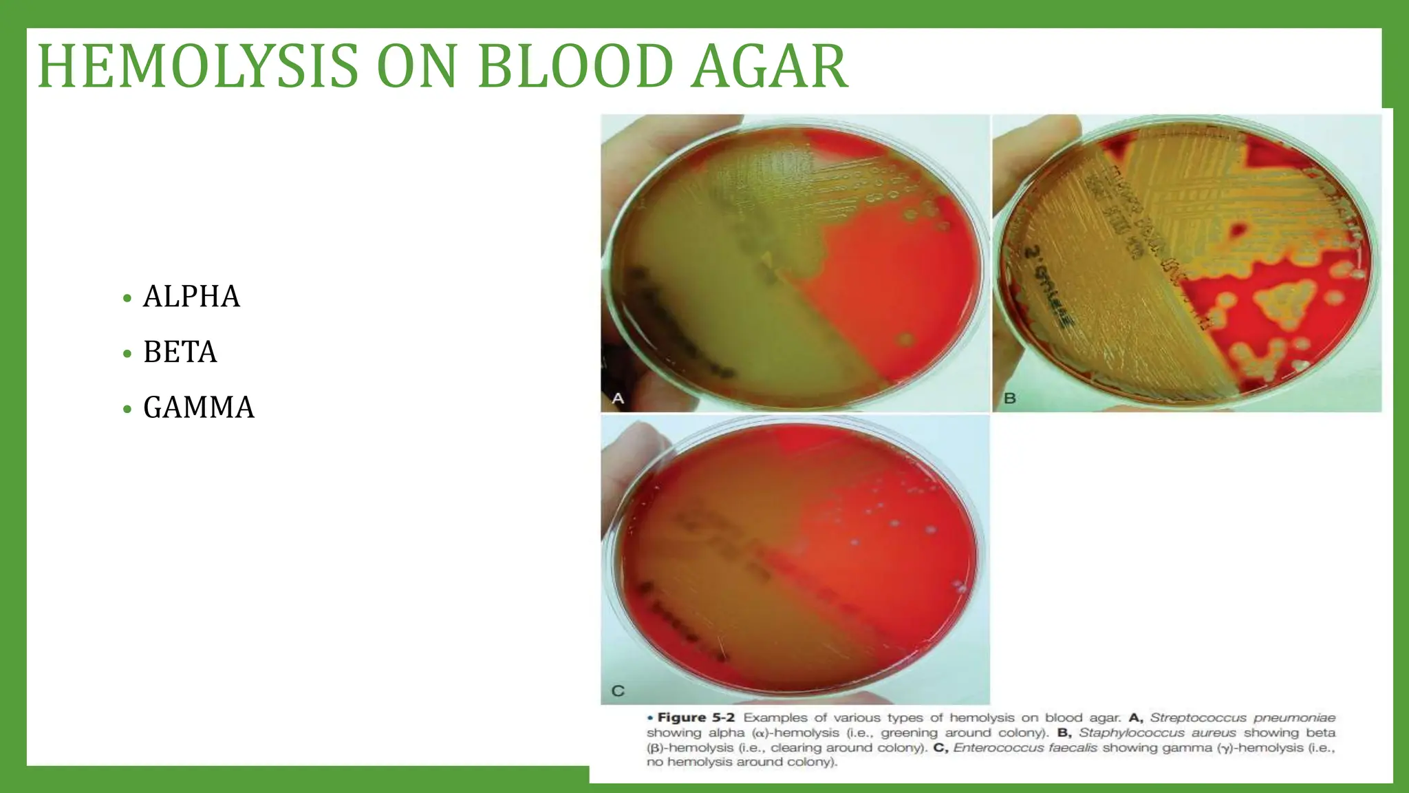 PHENOTYPIC METHODS OF Bacterial identification- conventional ...