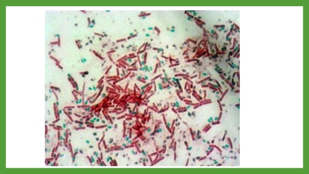 PHENOTYPIC METHODS OF Bacterial identification- conventional ...