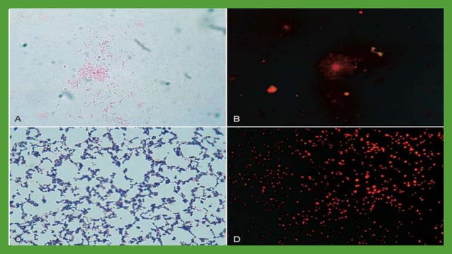 PHENOTYPIC METHODS OF Bacterial identification- conventional ...