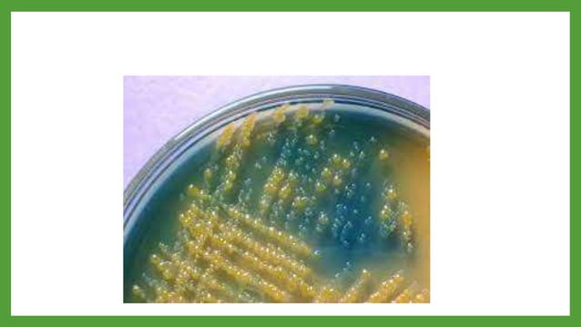 PHENOTYPIC METHODS OF Bacterial identification- conventional ...