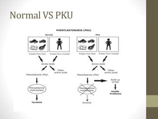 Phenylketonuria | PPSX