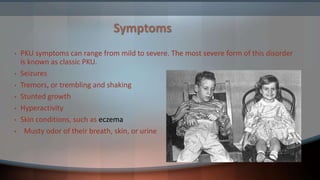 Phenylketonuria | PPT