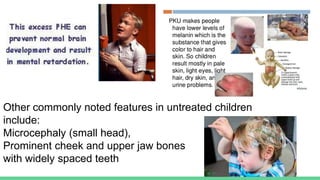 People With Phenylketonuria