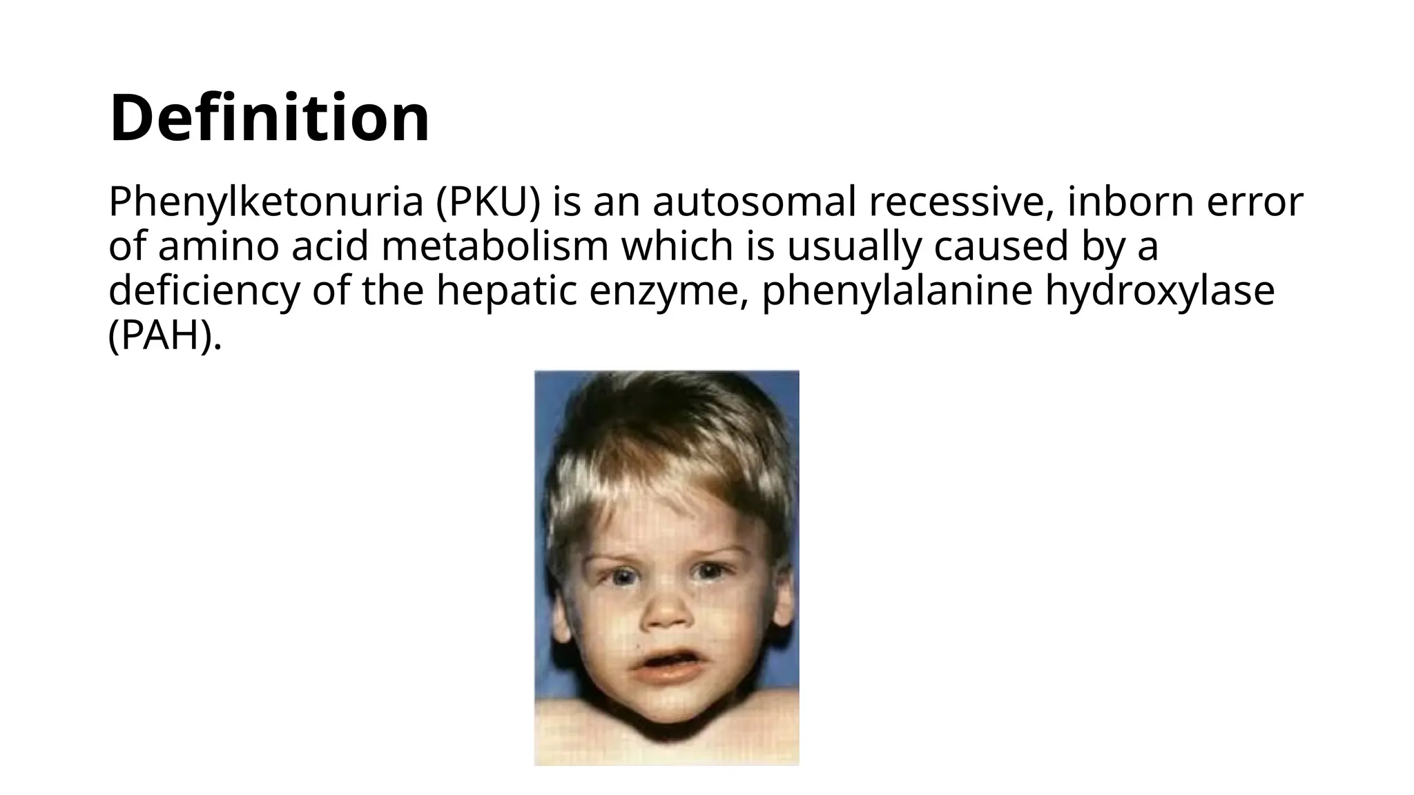 PHENYLKETONURIA. CAUSES SIGN AND SYMPTOMSpptx ABHILAL KURUPALATH | PPTX