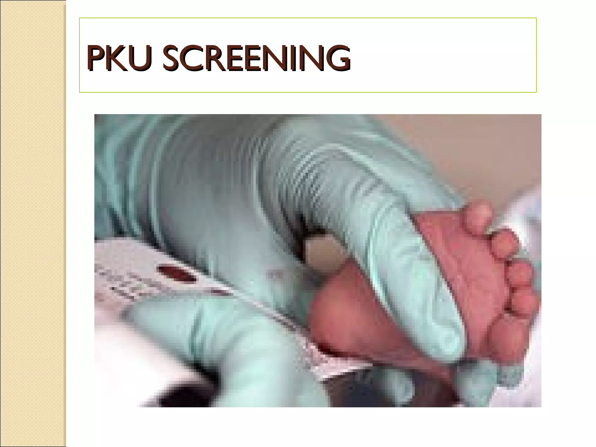 Phenylketonuria (PKU) | PPT