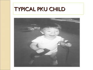 Phenylketonuria (PKU) | PPT