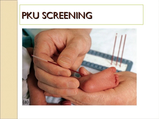 Phenylketonuria Pku