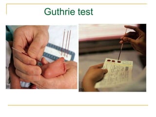 Inborn Erros of Metabolism - Phenyl ketonuria, alkaptonuria, albinism ...