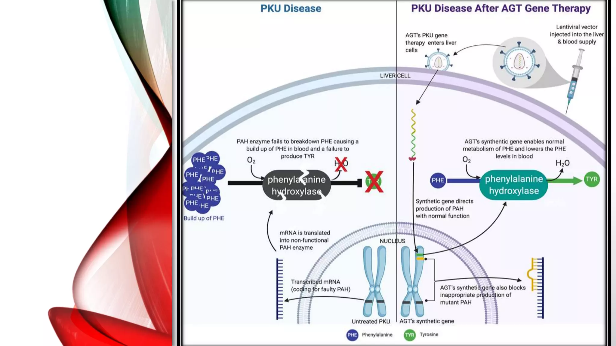 Phenylketonuria(pku) new | PPTX