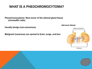 Pheochromocytoma | PPTX | Endocrine and Metabolic Diseases | Diseases ...