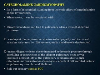 Pheochromocytoma dr ashish nair | PPT