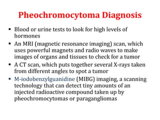Pheochromocytoma | PPTX