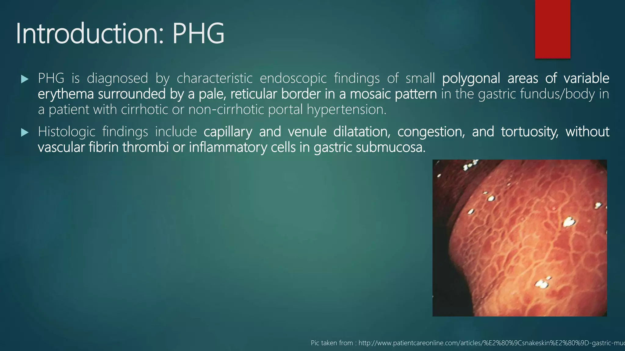 PORTAL HYPERTENSIVE GASTROPATHY | PPTX